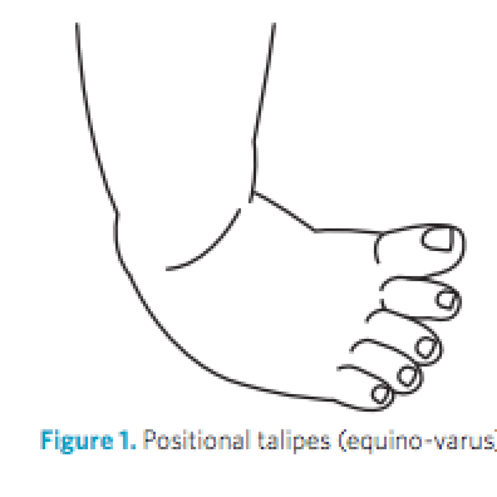 Paediatric Othopaedics | Surgeons | Sports Medicine | Ballarat OSM