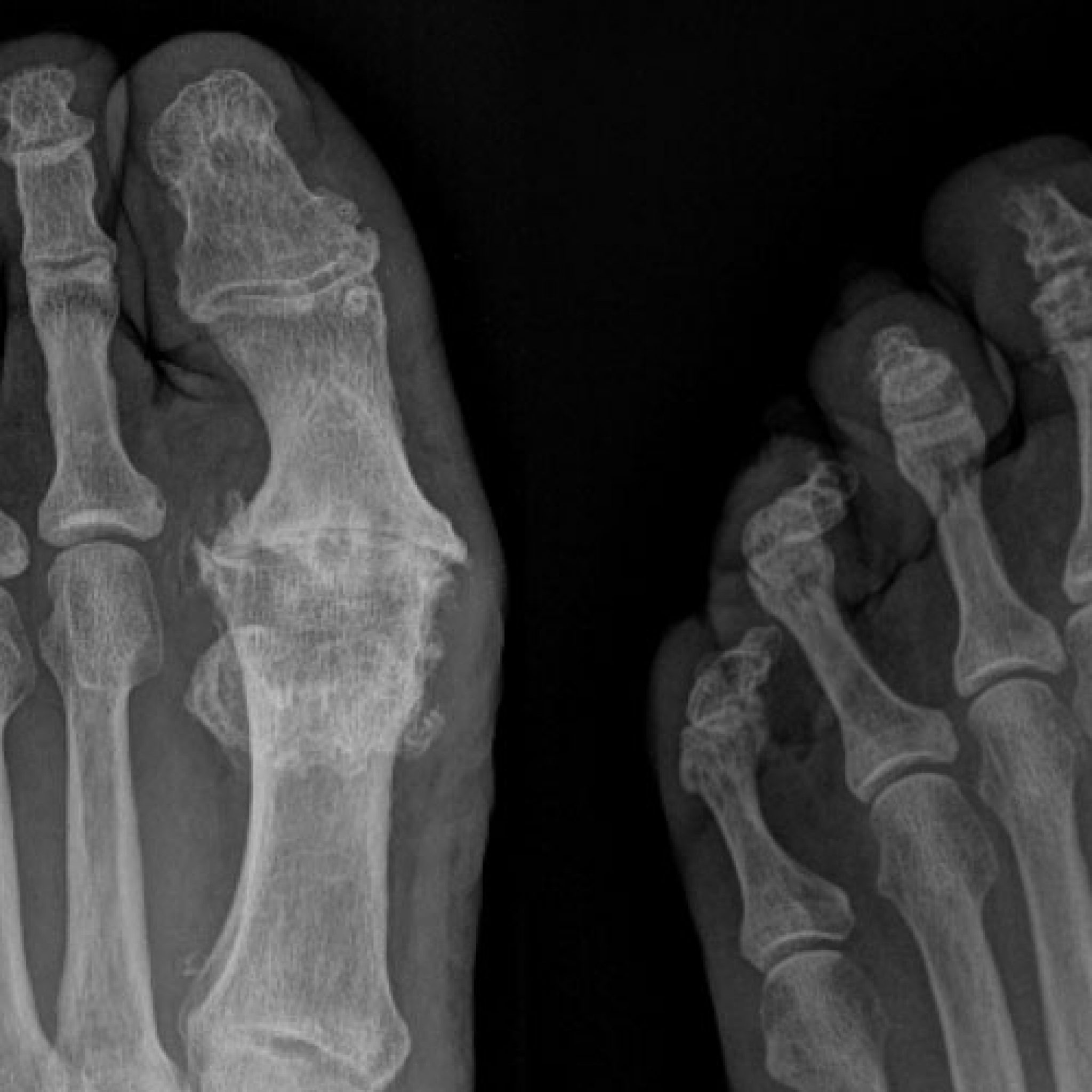 Foot & Ankle Surgery | Surgeons & Physicians | Ballarat OSM