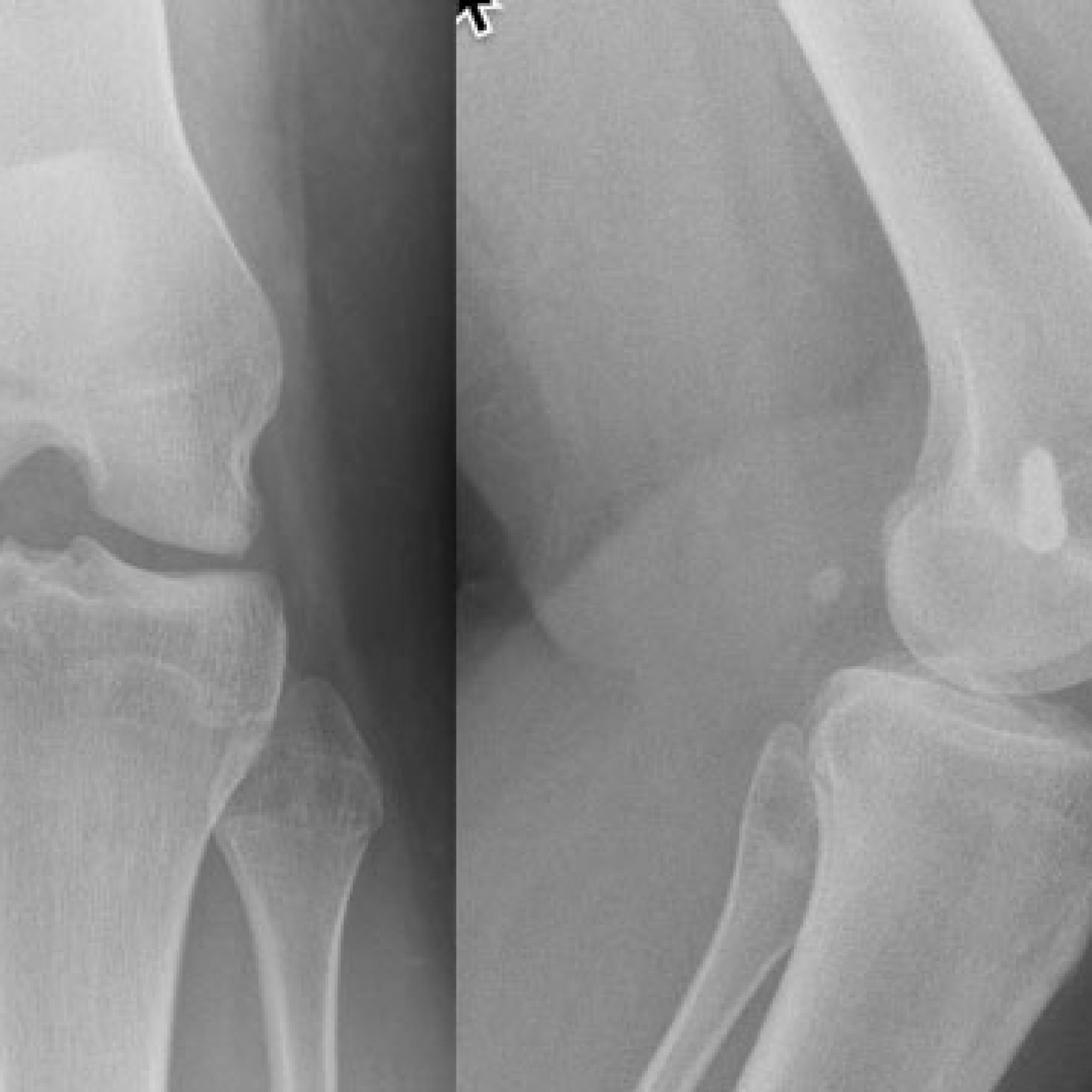 sports-injuries-patella-dislocation-1 - BallaratOSM | Ballarat ...