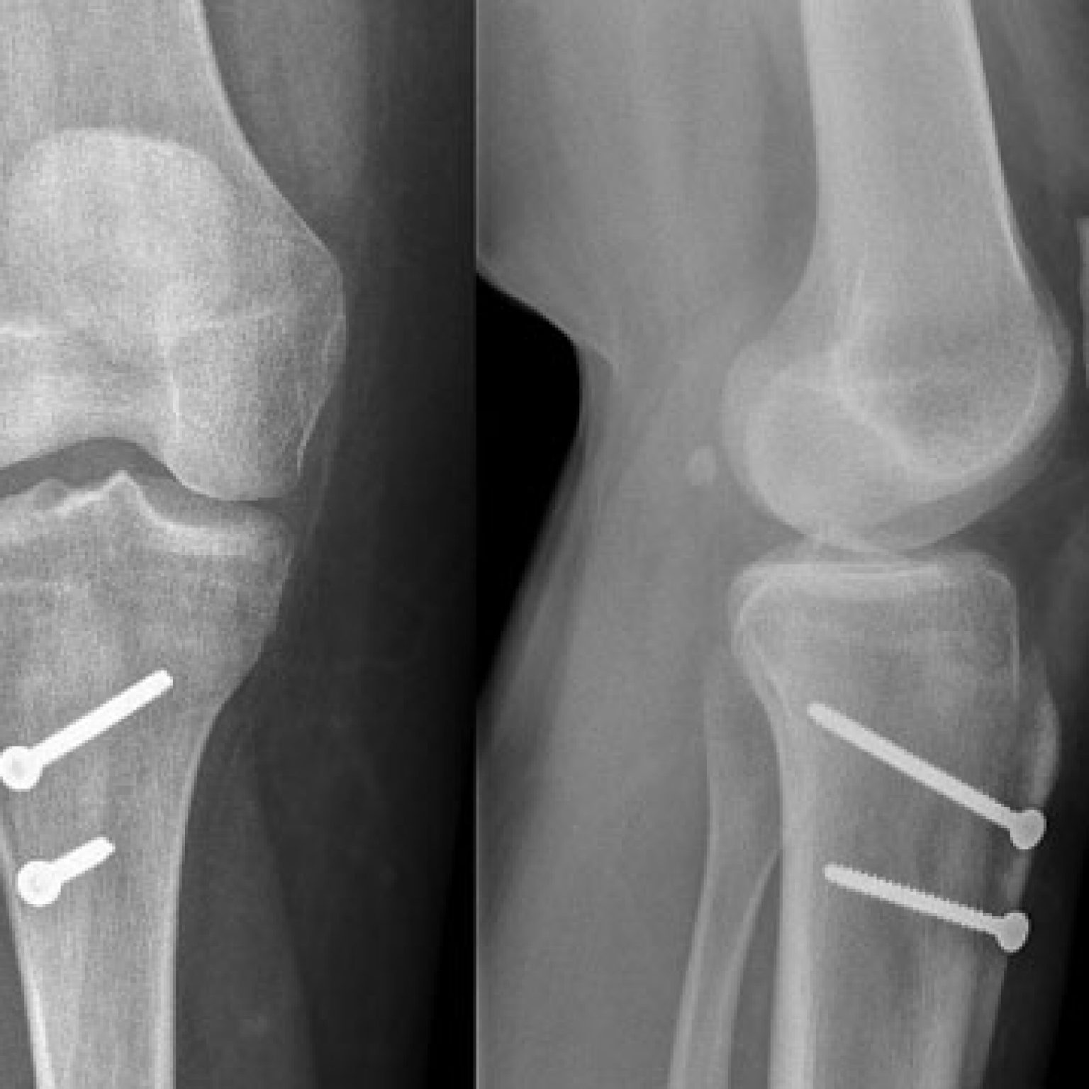 Orthopaedic Surgeons | Orthopaedics & Sports Medicine | Ballarat OSM