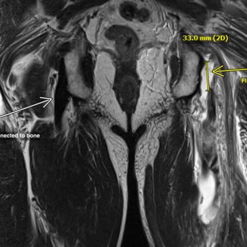 Orthopaedic Surgeons | Orthopaedics & Sports Medicine | Ballarat OSM