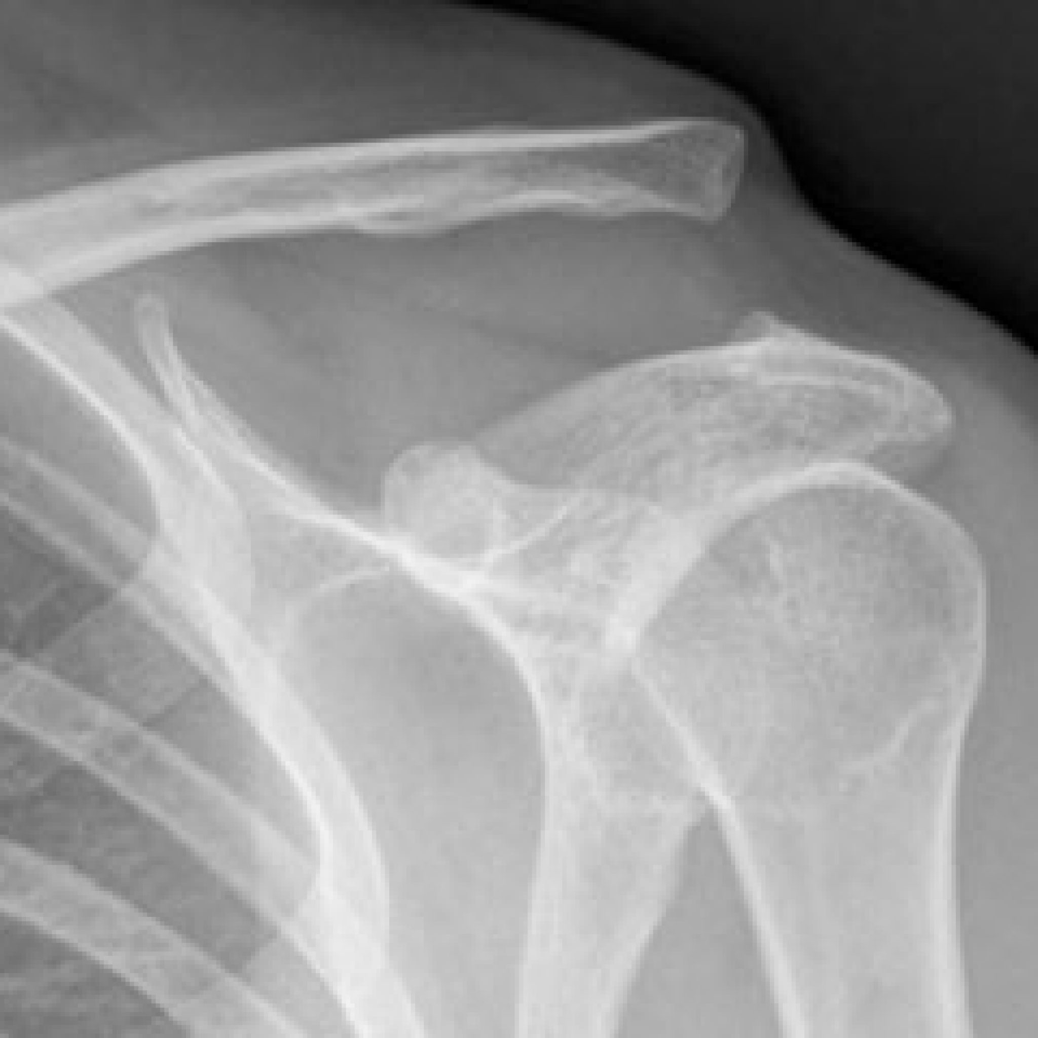 Orthopaedic Surgeons | Orthopaedics & Sports Medicine | Ballarat OSM