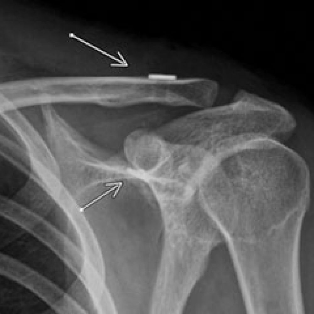 Orthopaedic Surgeons | Orthopaedics & Sports Medicine | Ballarat OSM